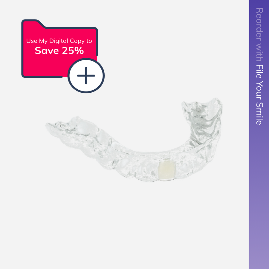 Denture Retainers – ClearRetain
